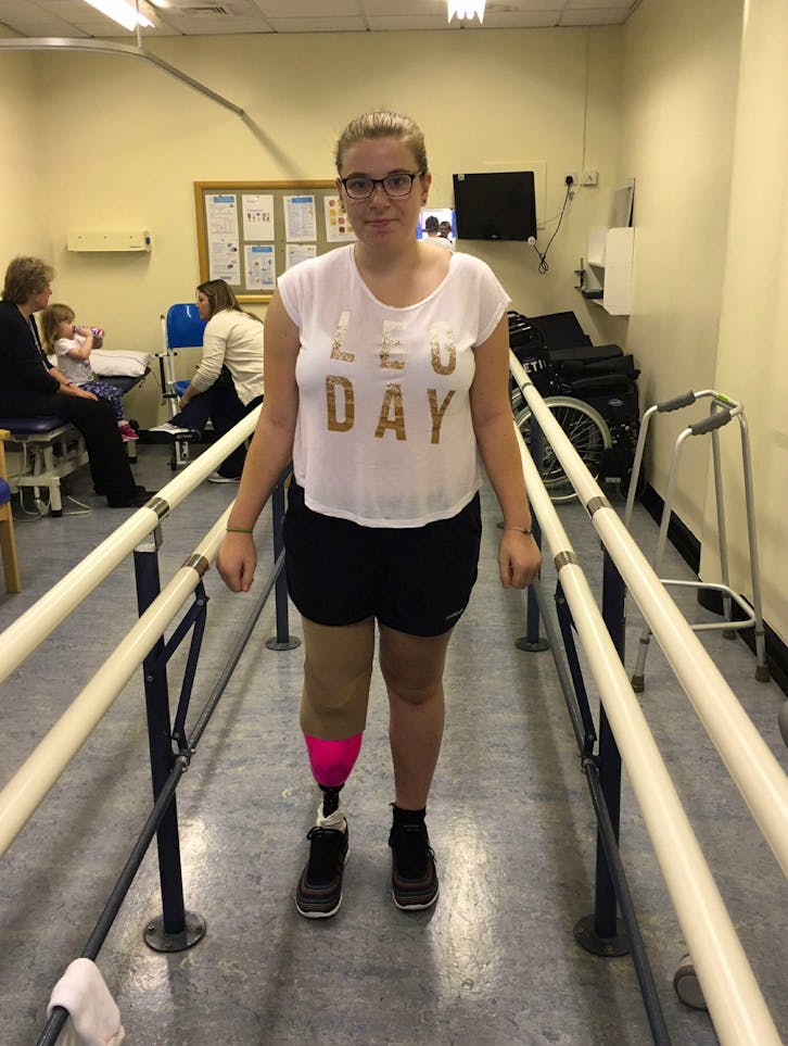 Hannah (21): «Bein-Amputation war die beste Entscheidung»