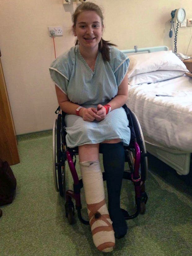 Hannah (21): «Bein-Amputation war die beste Entscheidung»