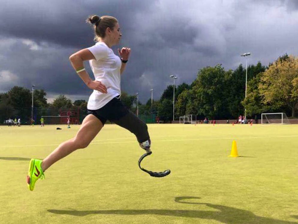 Hannah (21): «Bein-Amputation war die beste Entscheidung»