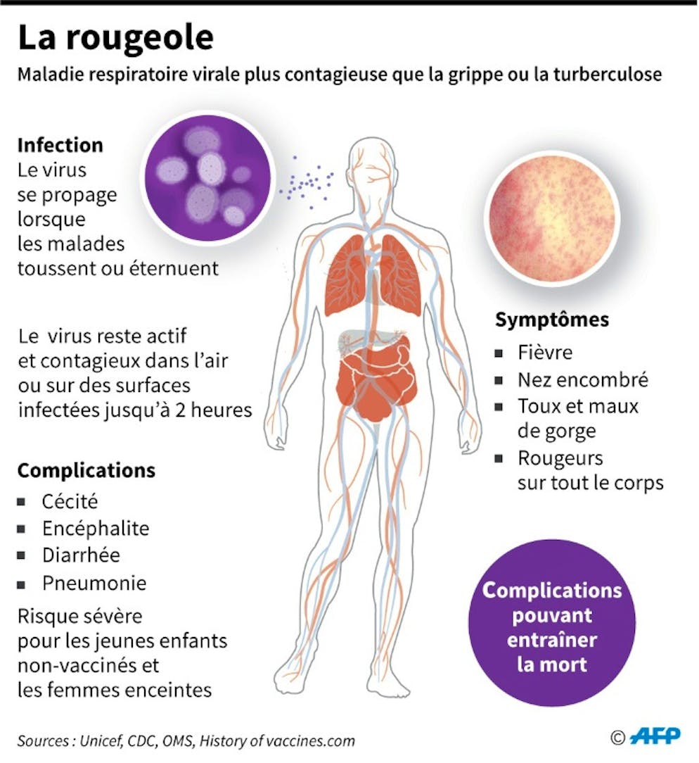 Sciences & Technique. Le virus de la rougeole remet à zéro vos défenses ...
