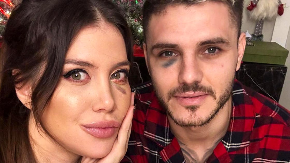 «Ci vergogniamo»: L'occhio nero di Icardi scalda gli animi del ...