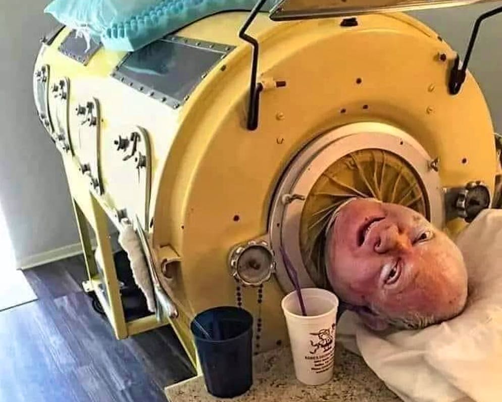 Fatale un'infezione da Covid: Paul Alexander è morto dopo oltre 70 anni ...