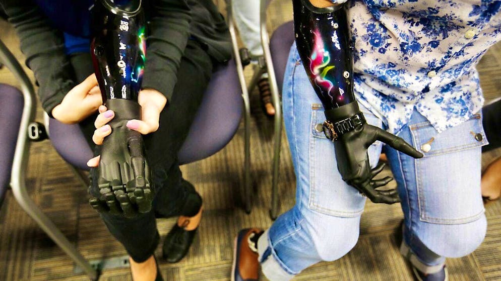 Medicine: New method aims to restore feeling to artificial limbs | blue News