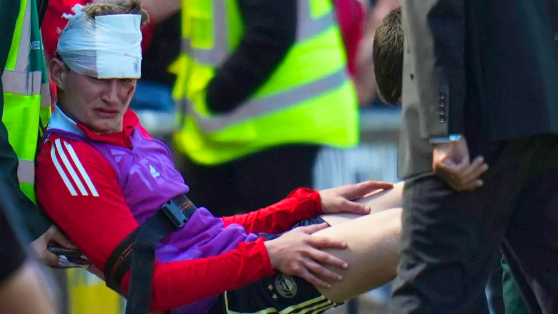 Professional footballer is hit by a seat shell and suffers serious ...