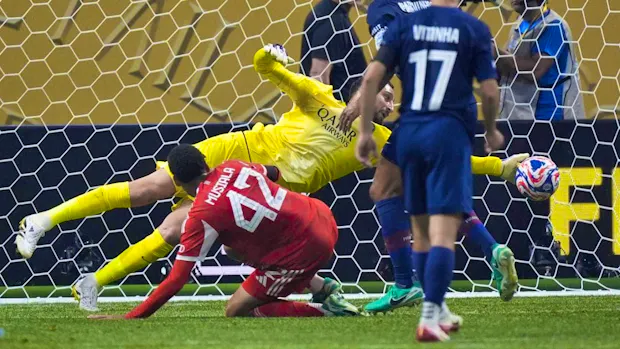Suspected broken leg: A loss and a shock for Bayern: Musiala suffers ...