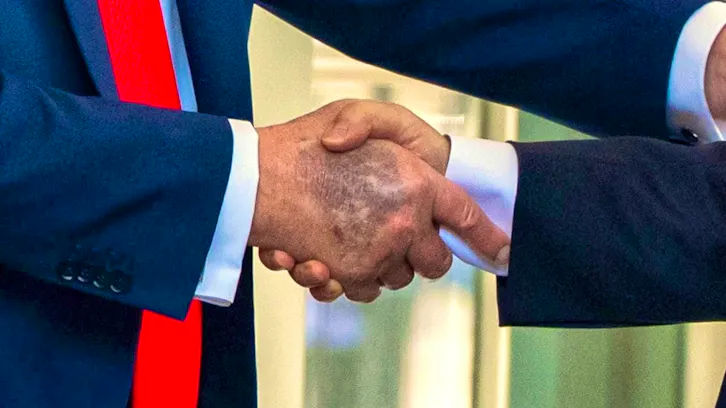 USA: Trump photographed again with a bruise on his hand | blue News
