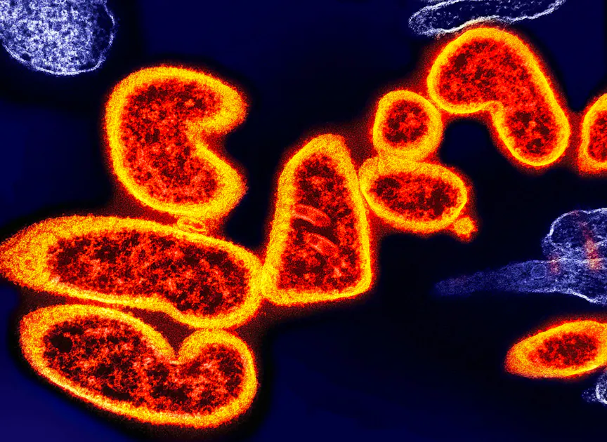 È altamente mortale: Segnalati due casi d'infezione da virus Nipah in ...